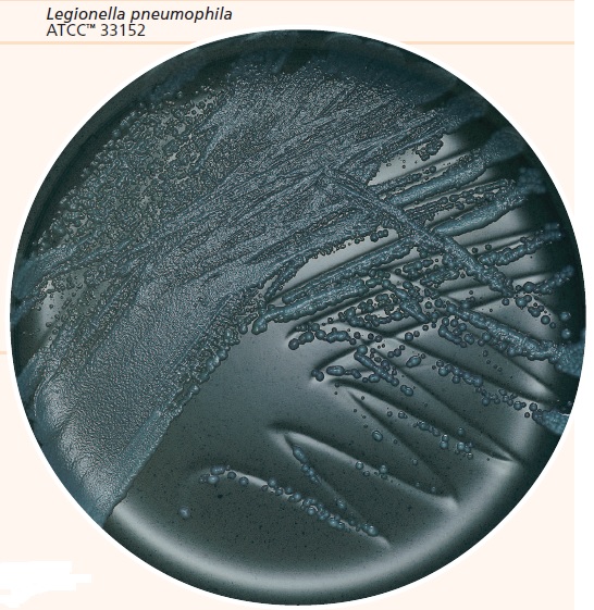 BCYE Agar Base - Interlab
