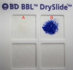 DrySlide Oxidase Test - Interlab