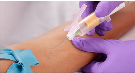 Agulha Vacutainer Eclipse 32X8mm - 21G 1 1/4 - (coleta a vácuo) - Interlab