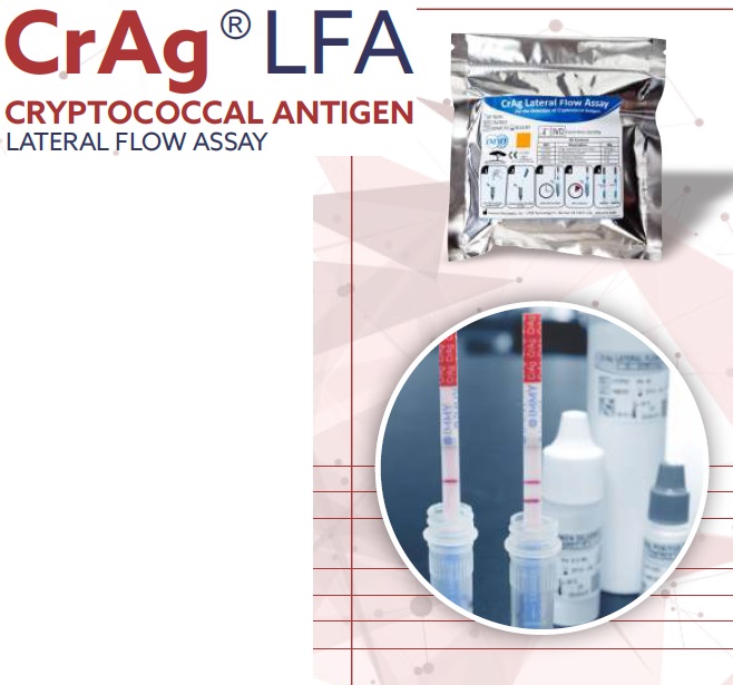 Cryptococcus Teste Rápido - (CrAg - Lateral Flow Assay) - Interlab