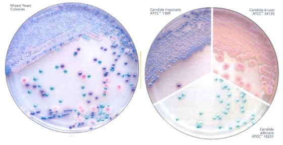 Chromagar Candida - Interlab