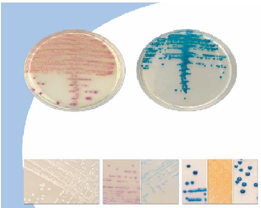 Chromagar Orientation - Interlab