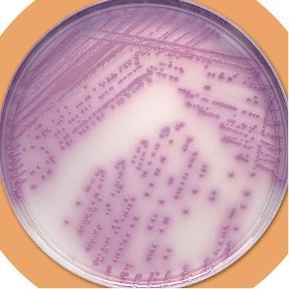 Chromagar Salmonella - Interlab