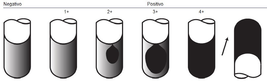 Coagulase Plasma Rabbit Lyophilized - Interlab