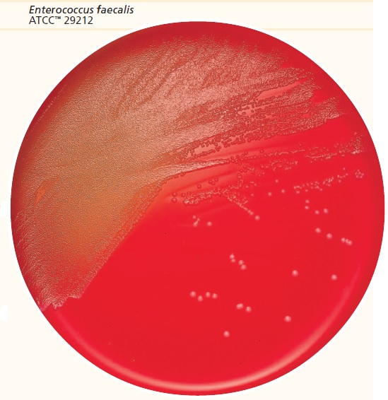 Columbia CNA Agar - Interlab