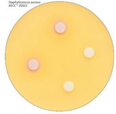 D/E (Dey/Engley) Neutralizing Agar - Interlab