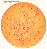 Desoxycholate Agar - Interlab