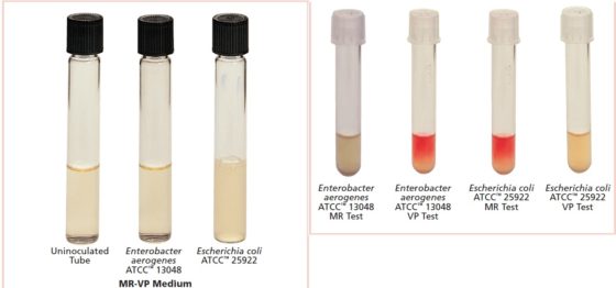 MR-VP Broth - Interlab
