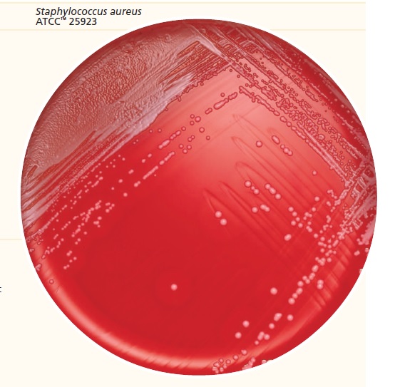 Phenylethyl Alcohol Agar - PEA - Interlab