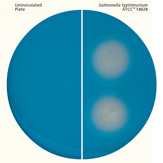 Rappaport-Vassiliadis (MSRV) Medium, Semisolid Modification - Interlab