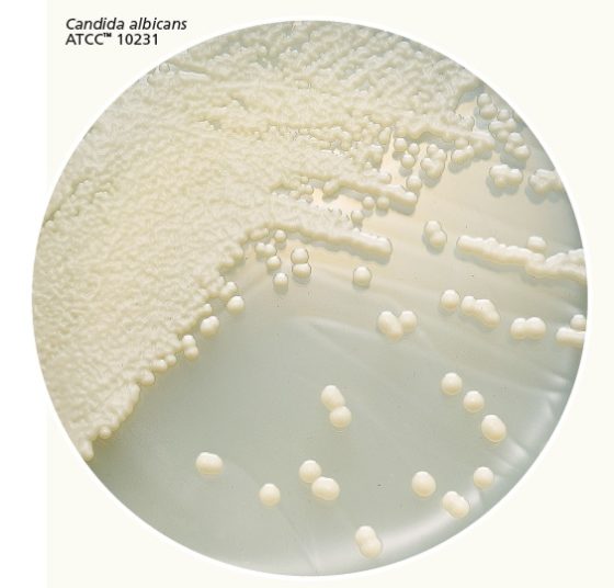 Sabouraud Dextrose Agar - Interlab