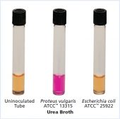 Urea Broth - Interlab