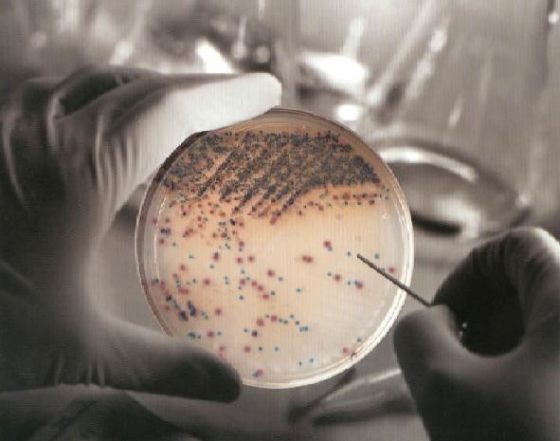Chromagar Orientation - Interlab